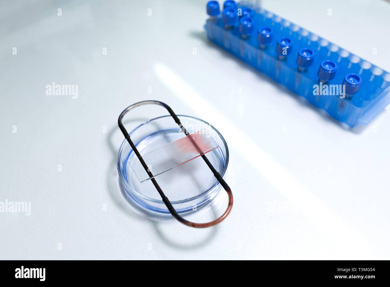 scientist prepare blood sample for research on microscope. Placing ...