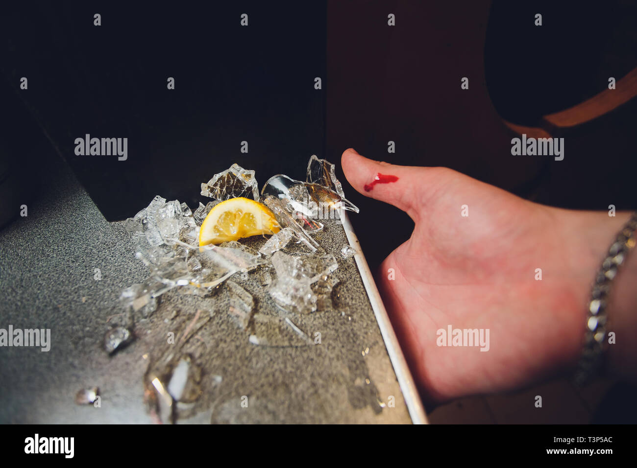 Splinter Hand High Resolution Stock Photography and Images - Alamy