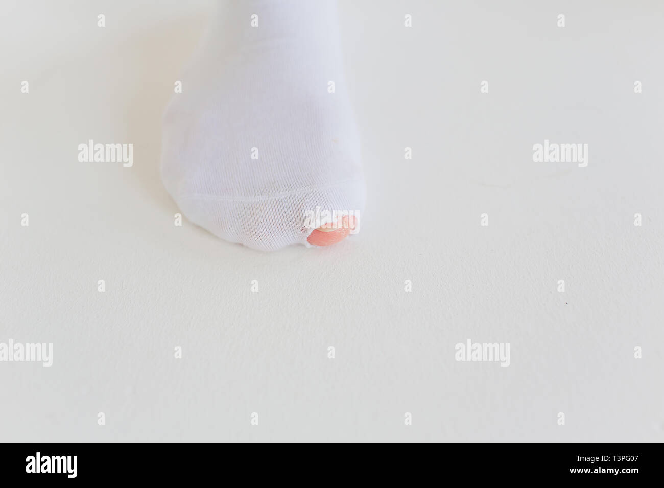Ripped stockings hi-res stock photography and images - Alamy