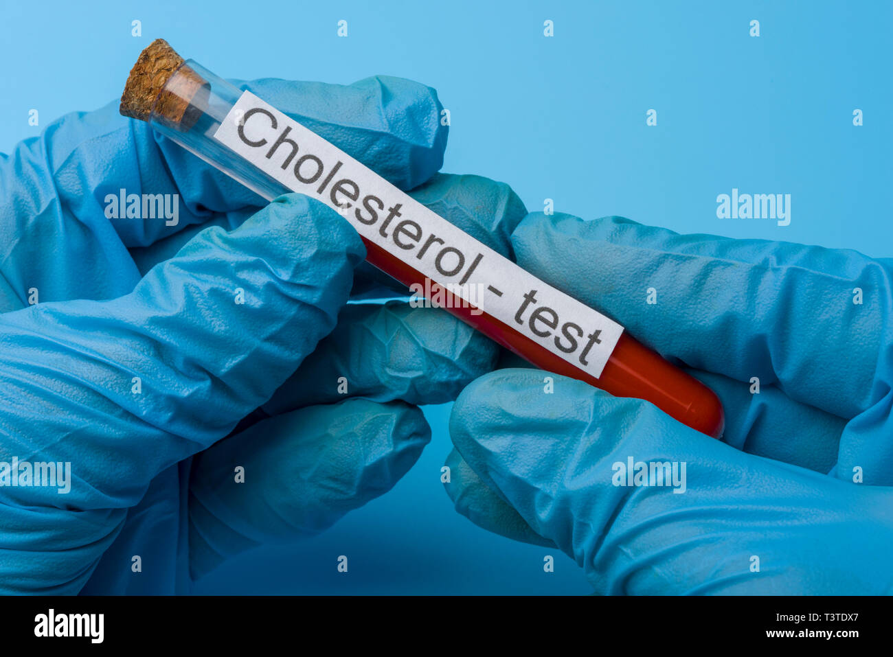 Lipid test hi-res stock photography and images - Alamy