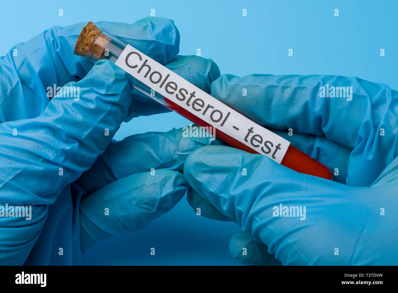 Hematological analysis hi-res stock photography and images - Alamy
