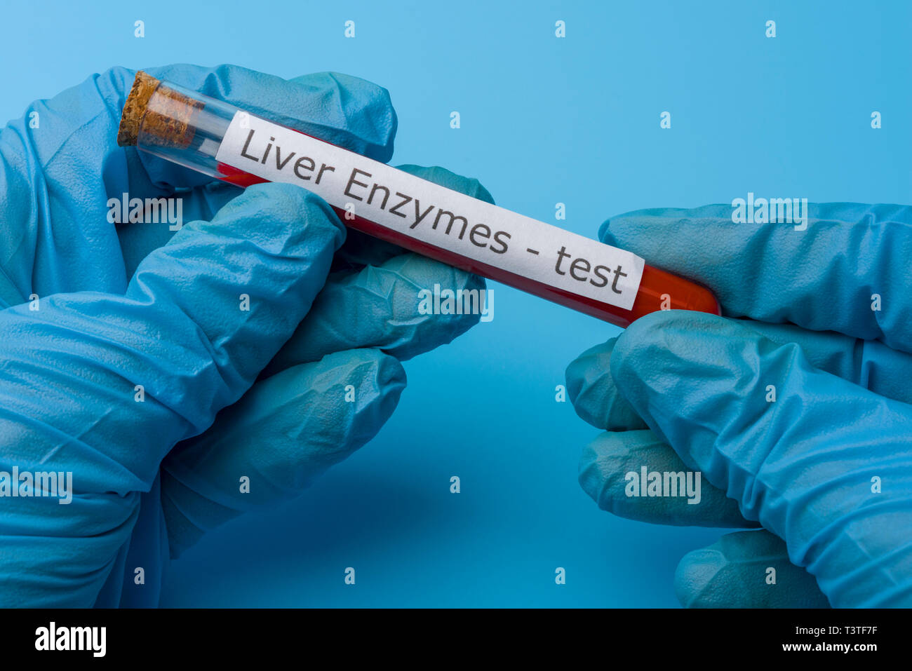 Enzyme experiment hi-res stock photography and images - Alamy