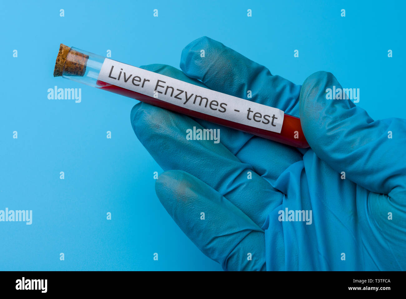 Hand Holding liver enzyme Test in vitro on Blue Background. The concept ...