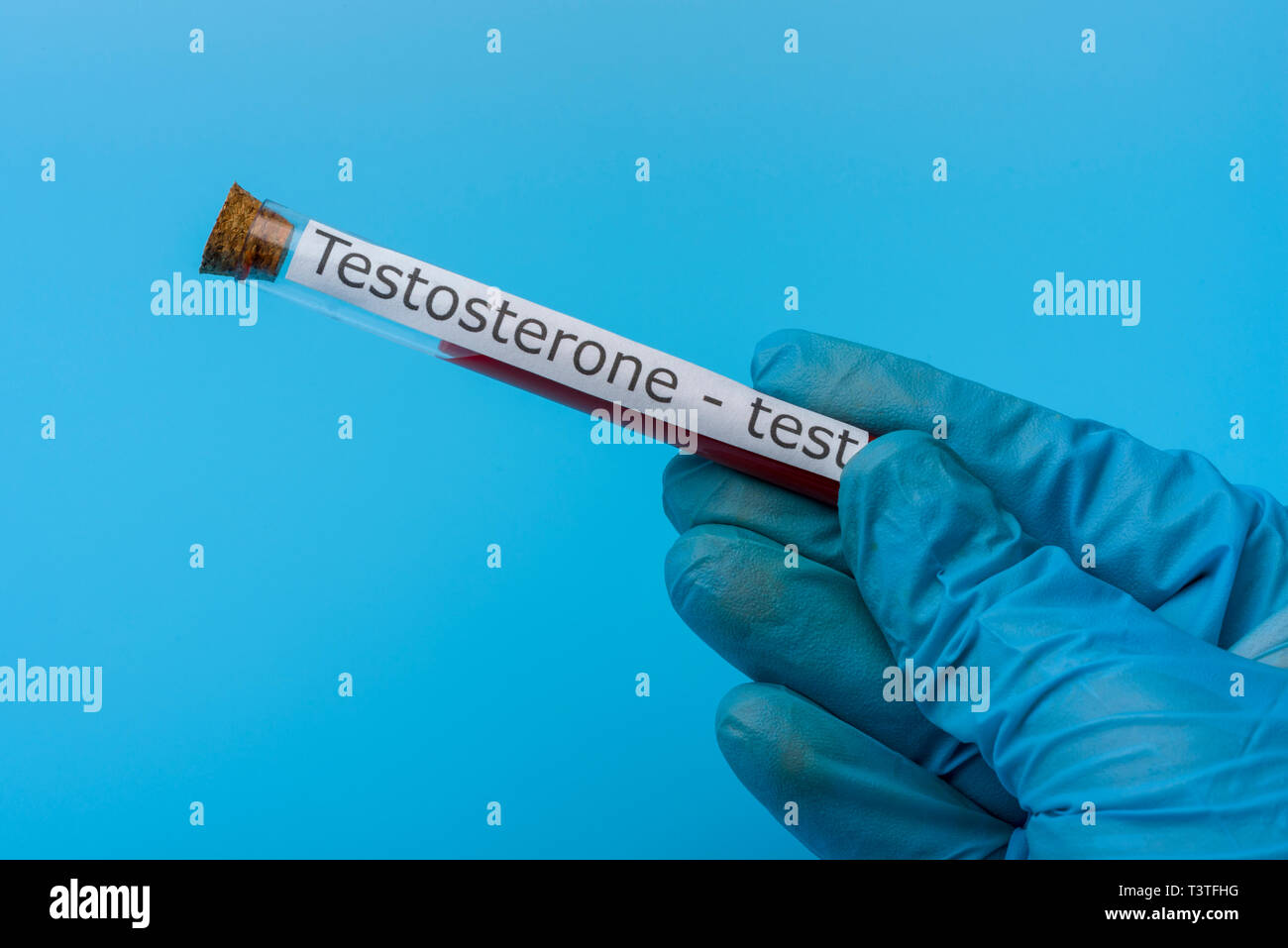 Hand Holding Test Testeron in vitro against a Blue Background. The ...