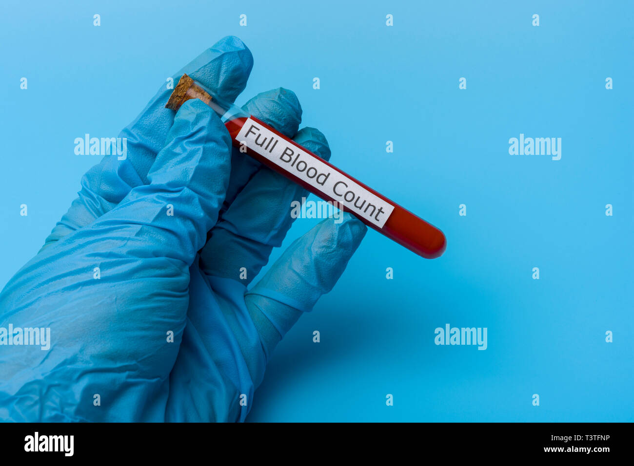 Hand Holding a Test for a Full blood Test in a test tube on a Blue ...