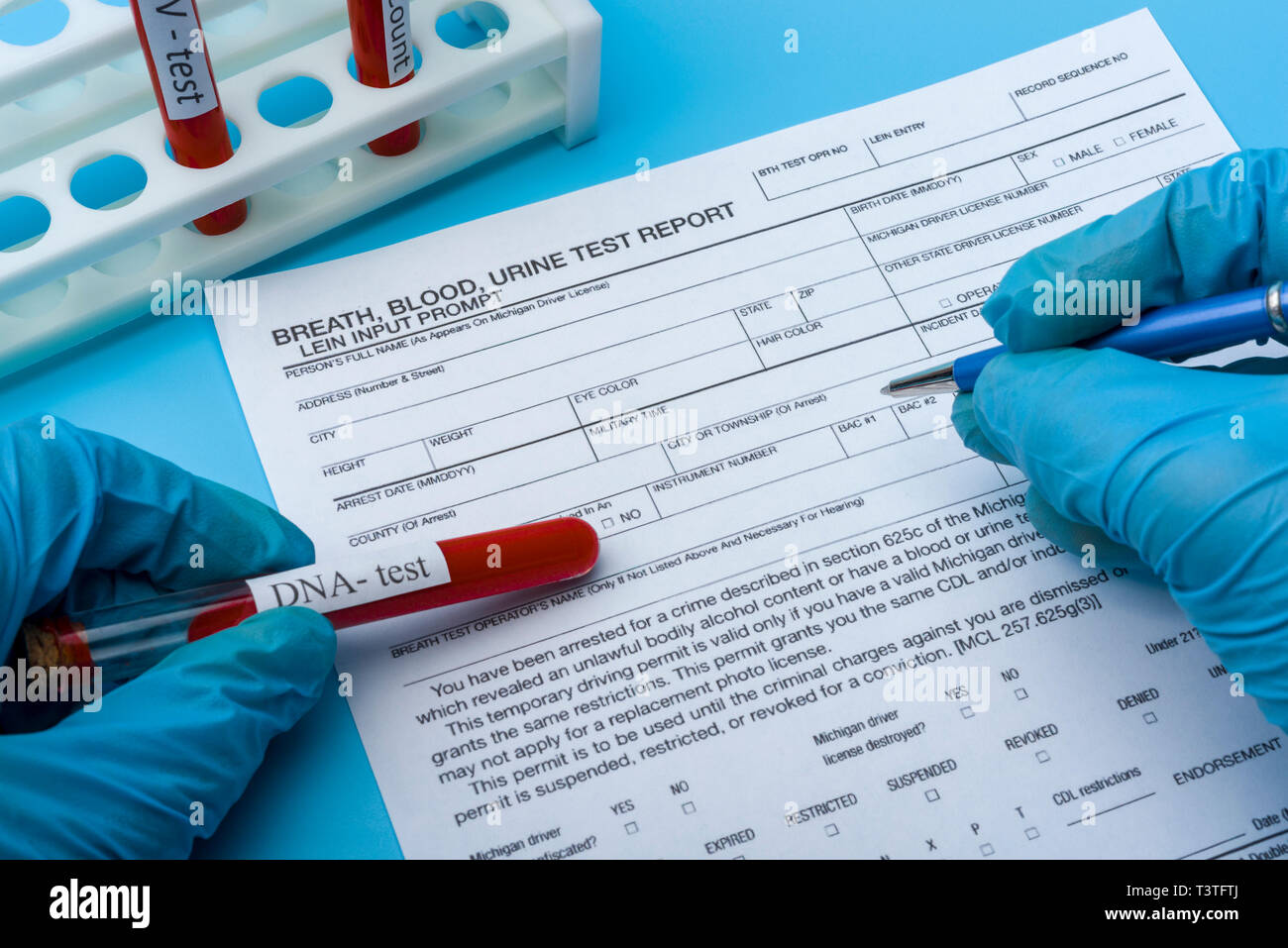DNA molecule forming inside the vial in for blood analysis Stock Photo ...