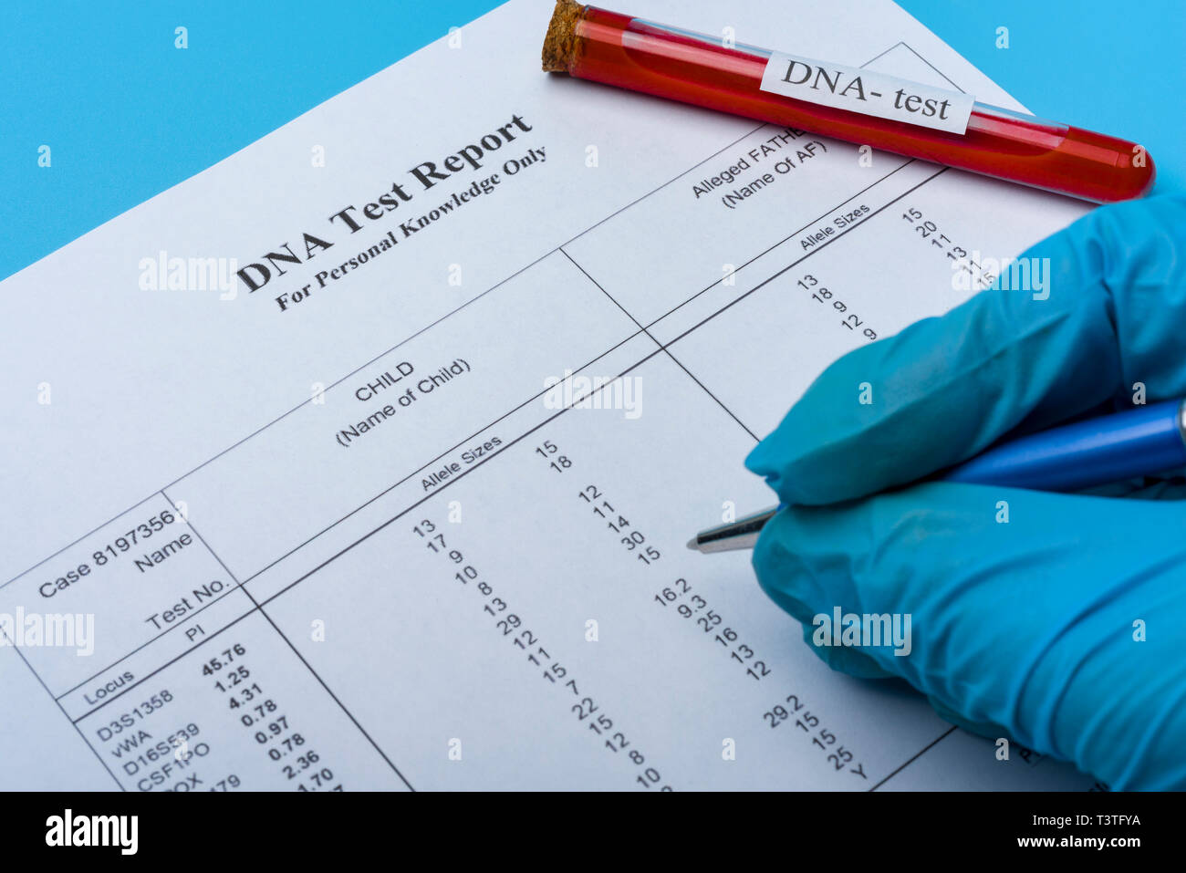 Vial of blood dna hi-res stock photography and images - Alamy