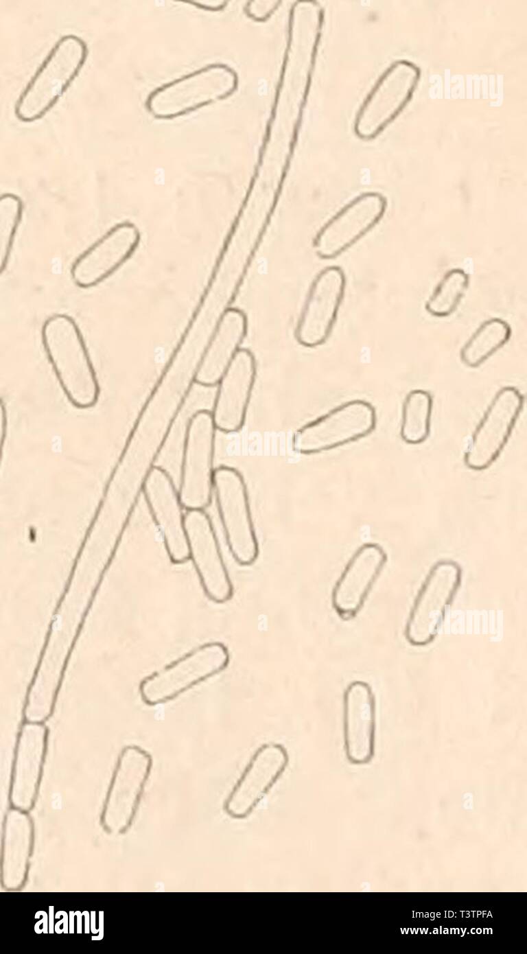 Typhus drawing hi-res stock photography and images - Alamy