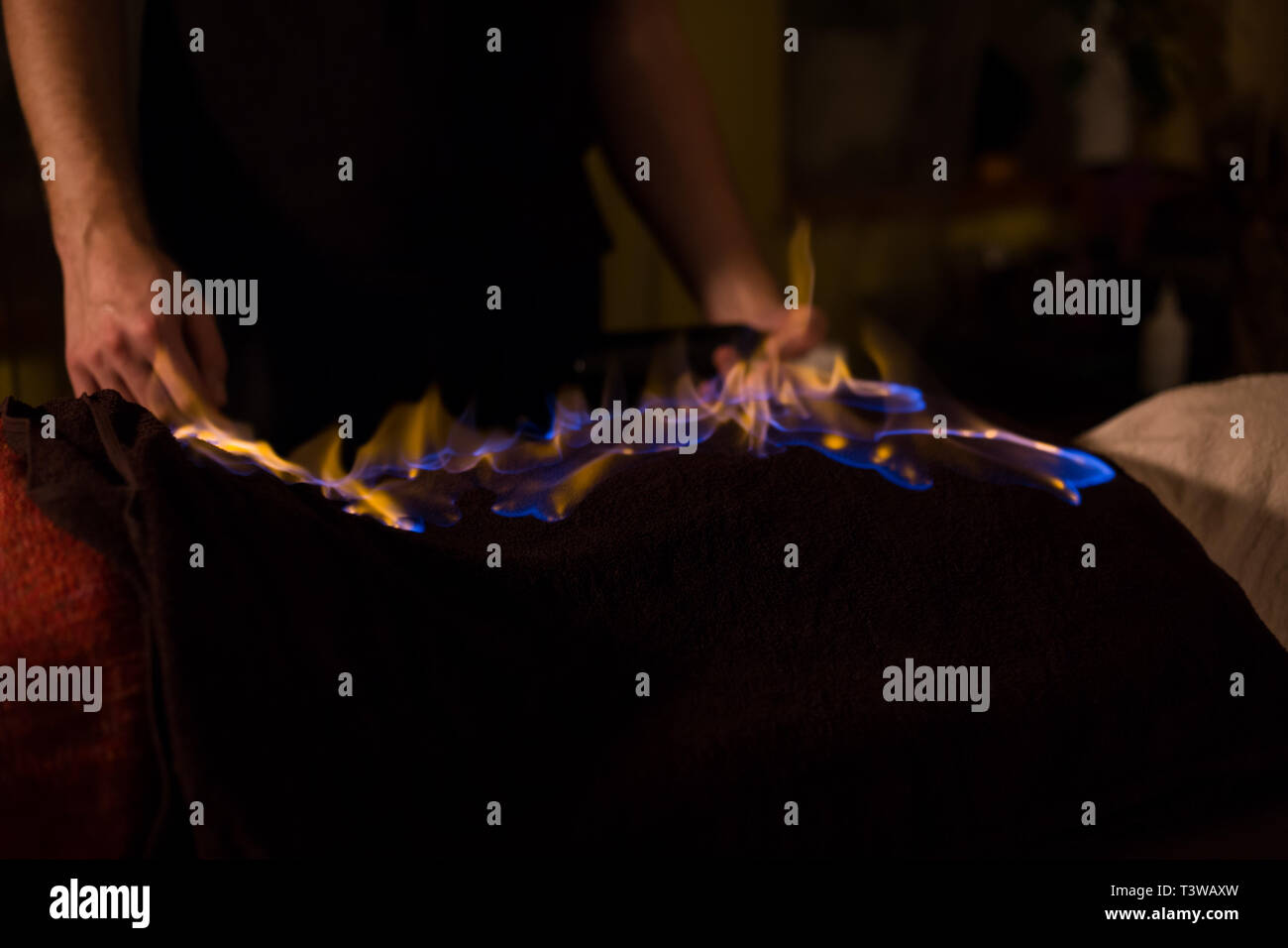 Chinese fire massage and therapy Stock Photo - Alamy