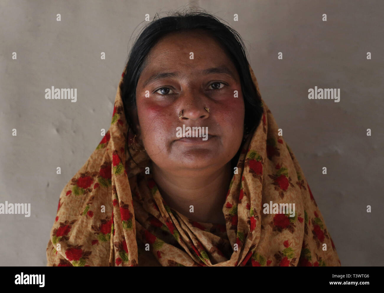 Human organ trafficking hi-res stock photography and images - Alamy