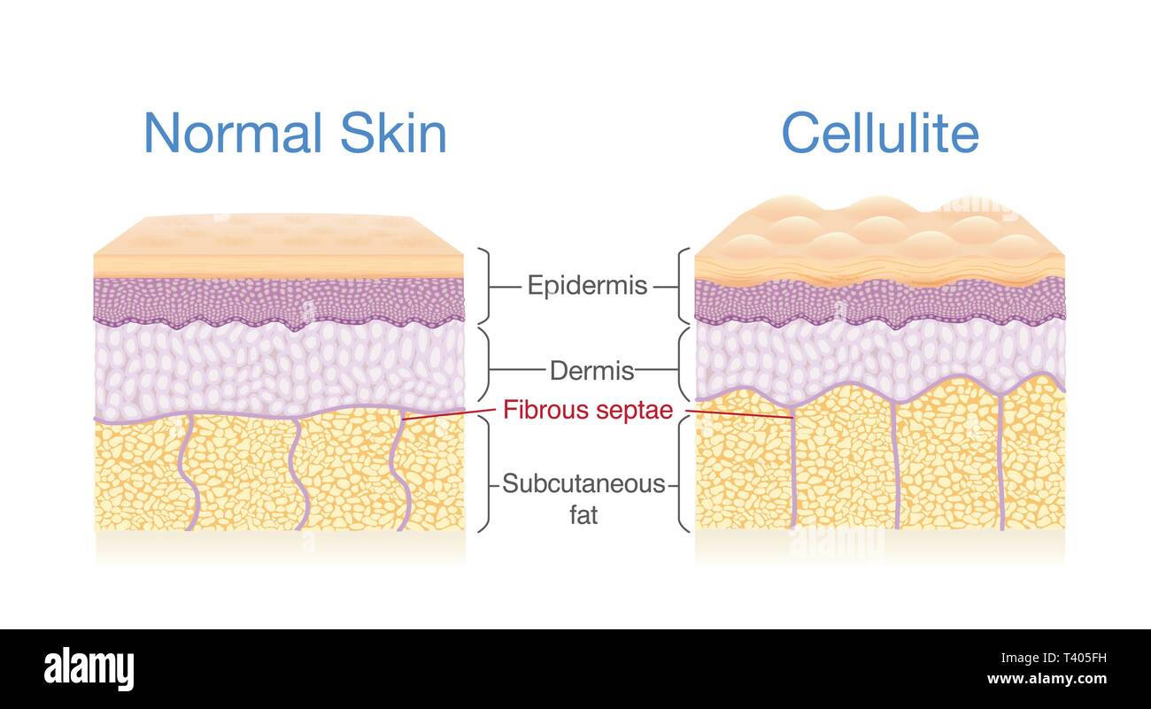Compare hi-res stock photography and images - Alamy