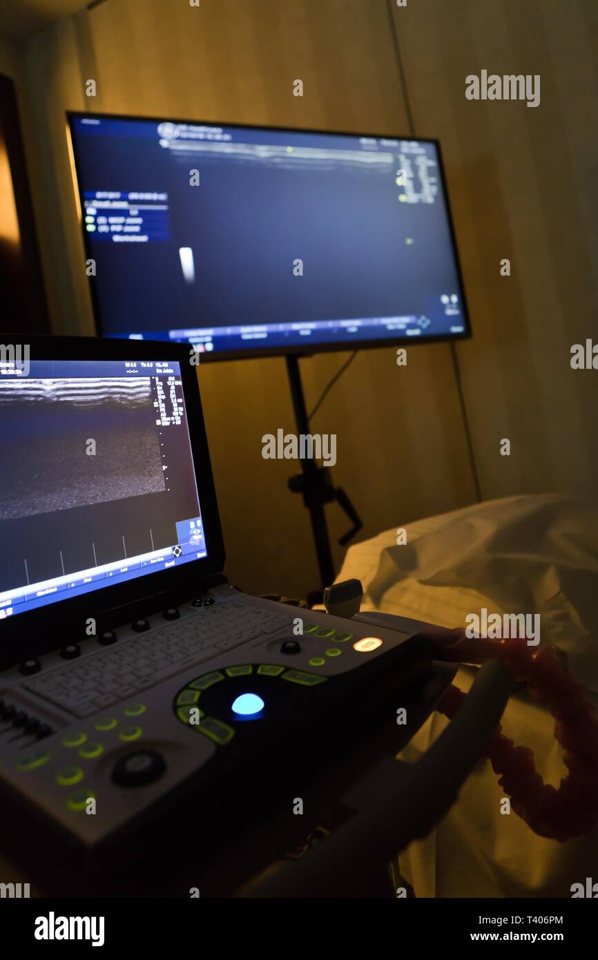 Real Sonography, ultrasonic scanning in dark room. Portable sonograph ...