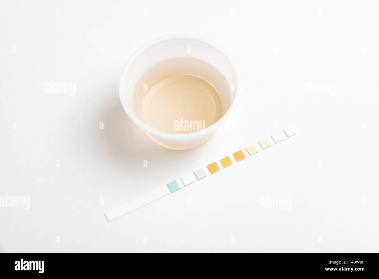 A urine sample in a plastic container with a reagent strip set on a ...