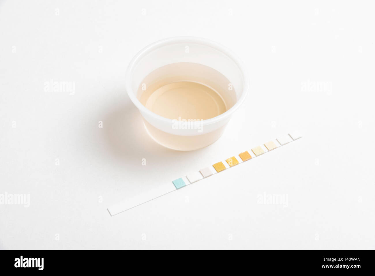 A urine sample in a plastic container with a reagent strip set on a ...