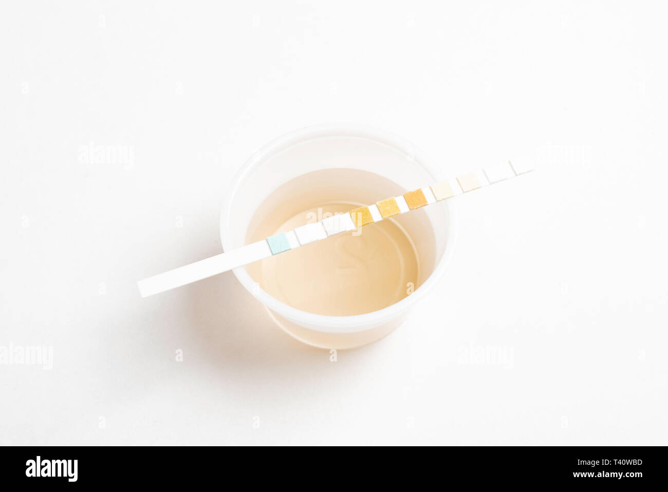 A urine sample in a plastic container with a reagent strip set on a ...
