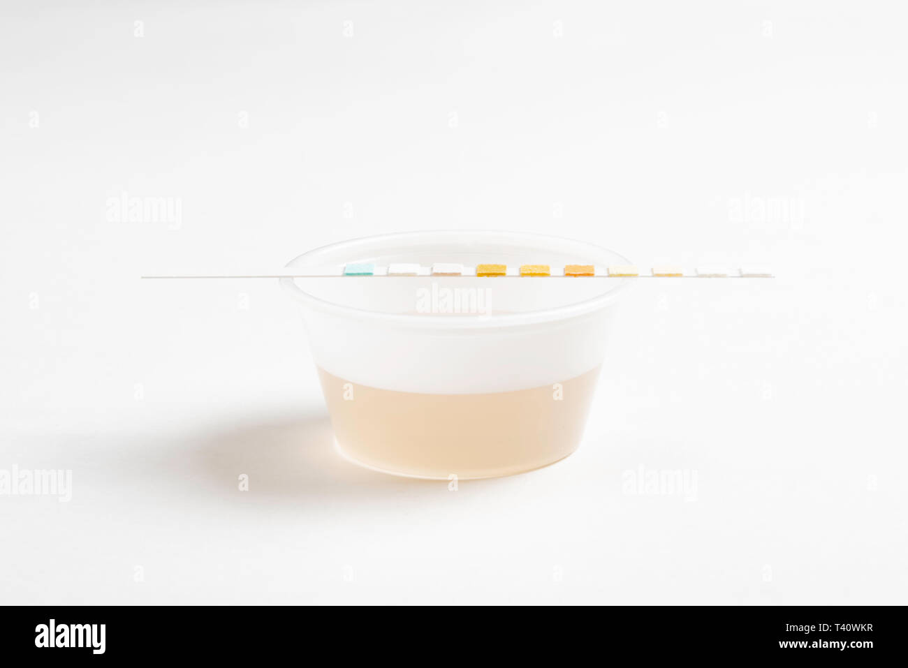A urine sample in a plastic container with a reagent strip set on a ...
