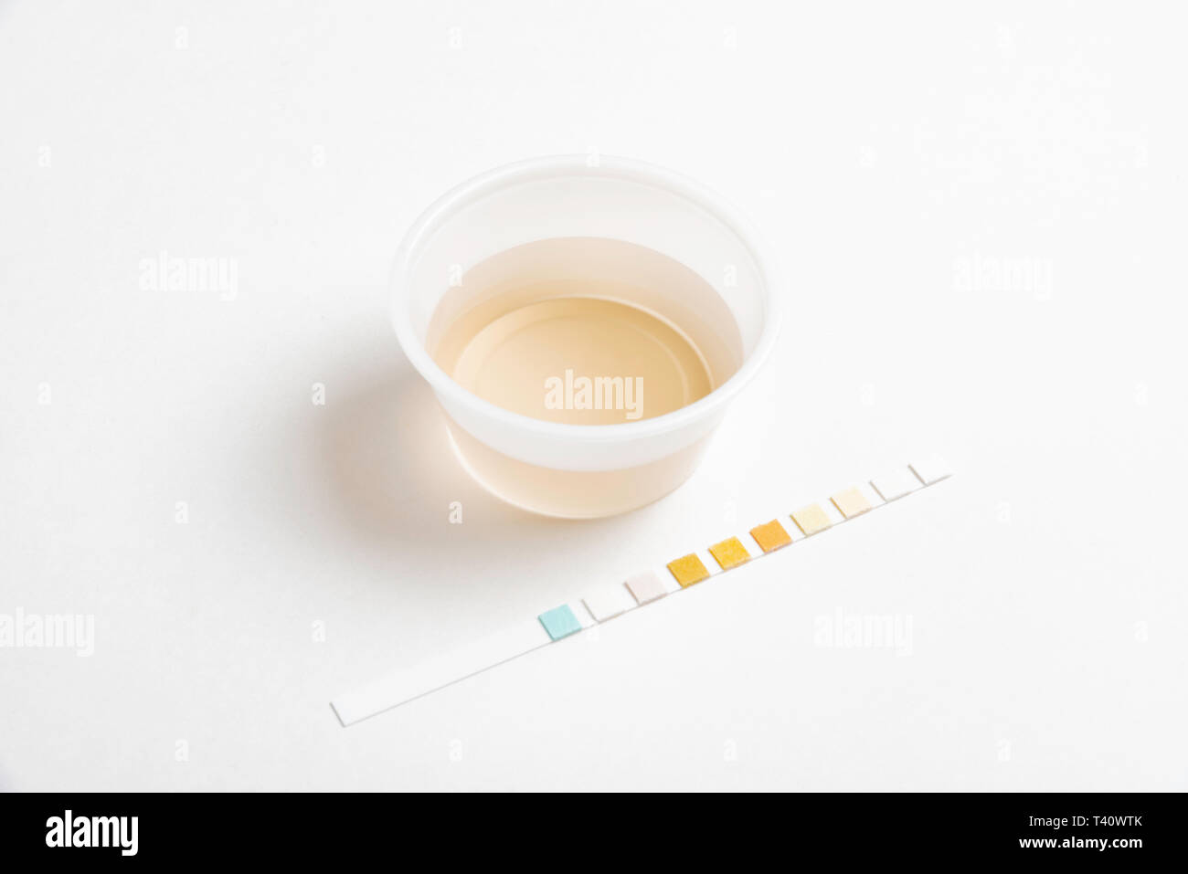 A urine sample in a plastic container with a reagent strip set on a ...