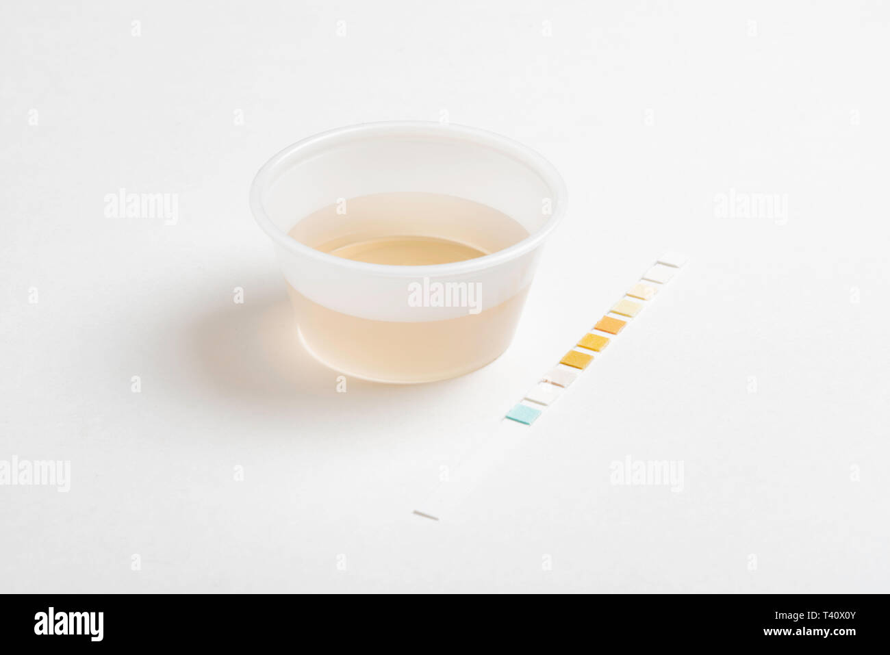 A urine sample in a plastic container with a reagent strip set on a ...