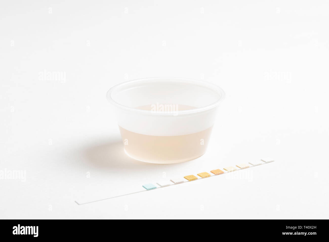 A urine sample in a plastic container with a reagent strip set on a ...