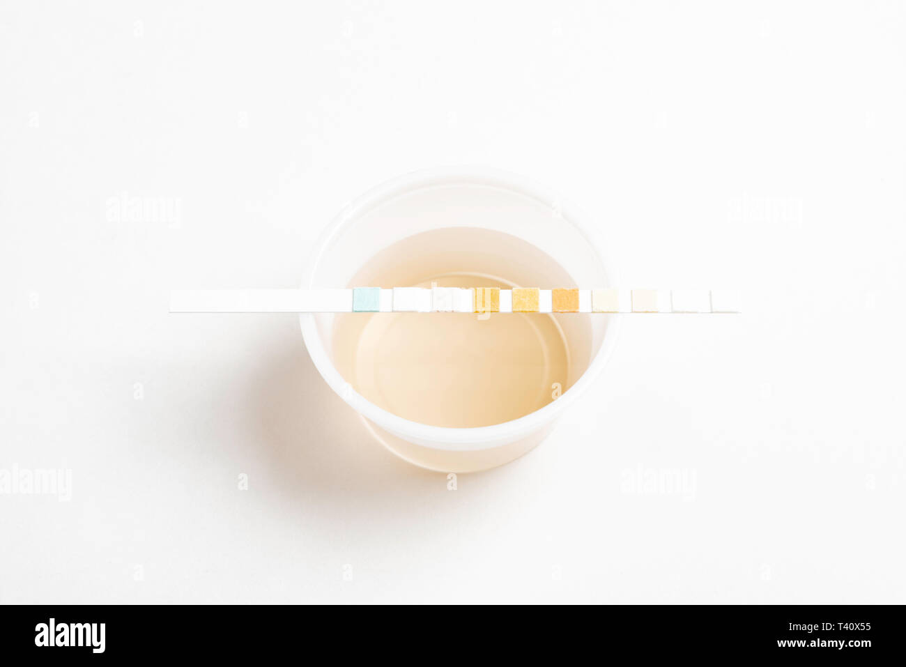 A urine sample in a plastic container with a reagent strip set on a ...