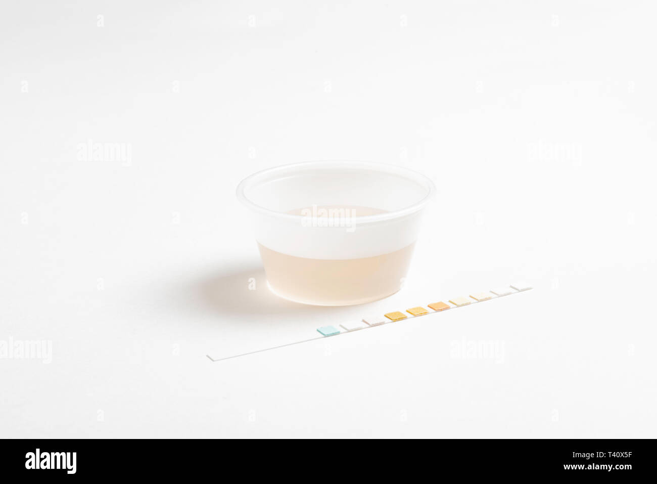 A urine sample in a plastic container with a reagent strip set on a ...