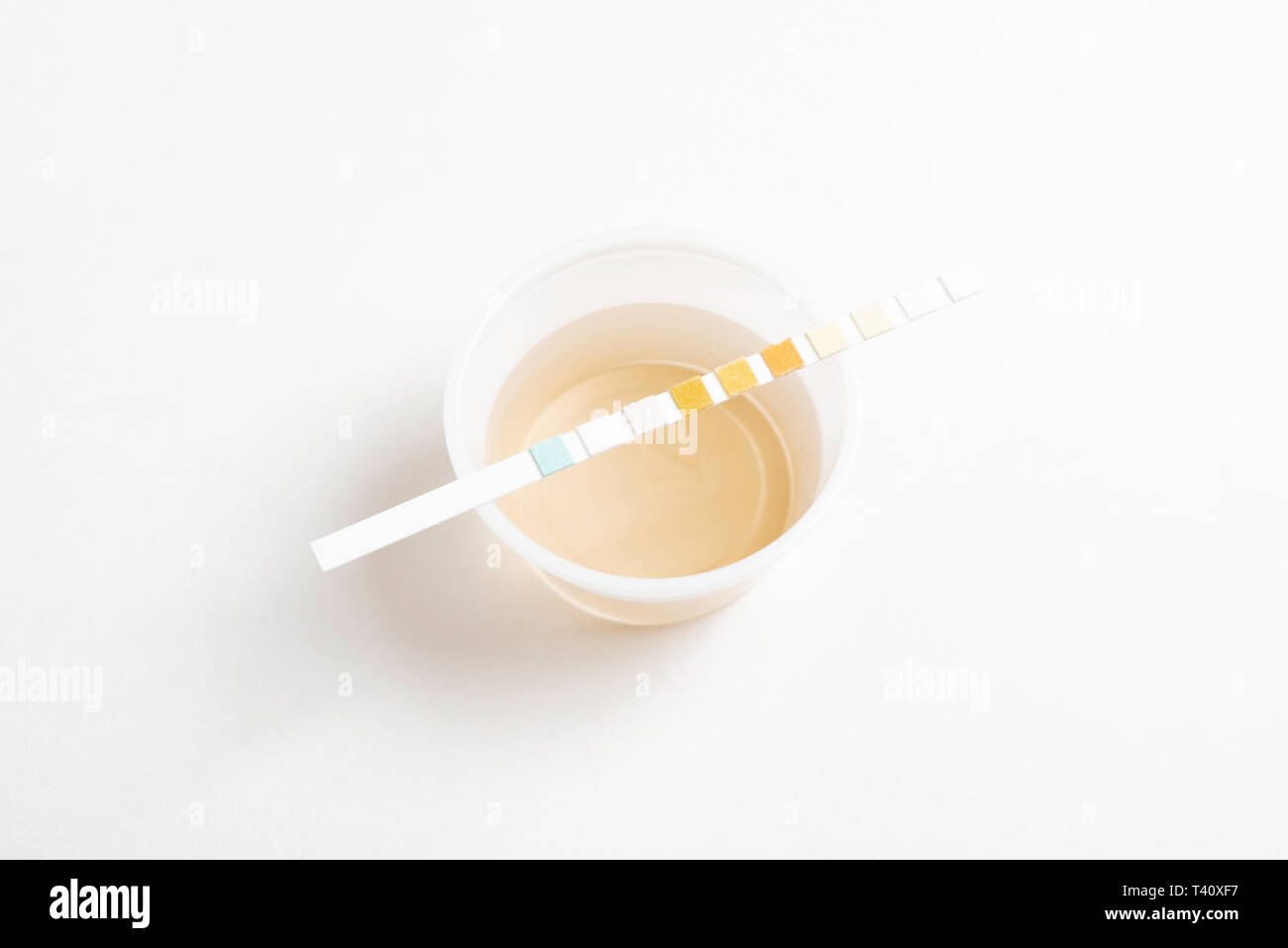 A urine sample in a plastic container with a reagent strip set on a ...