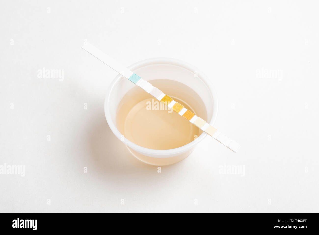 A urine sample in a plastic container with a reagent strip set on a ...