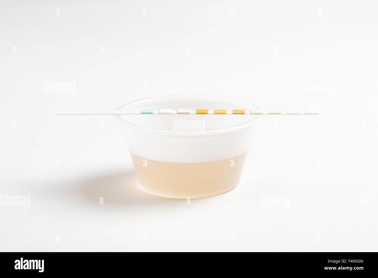 A urine sample in a plastic container with a reagent strip set on a ...