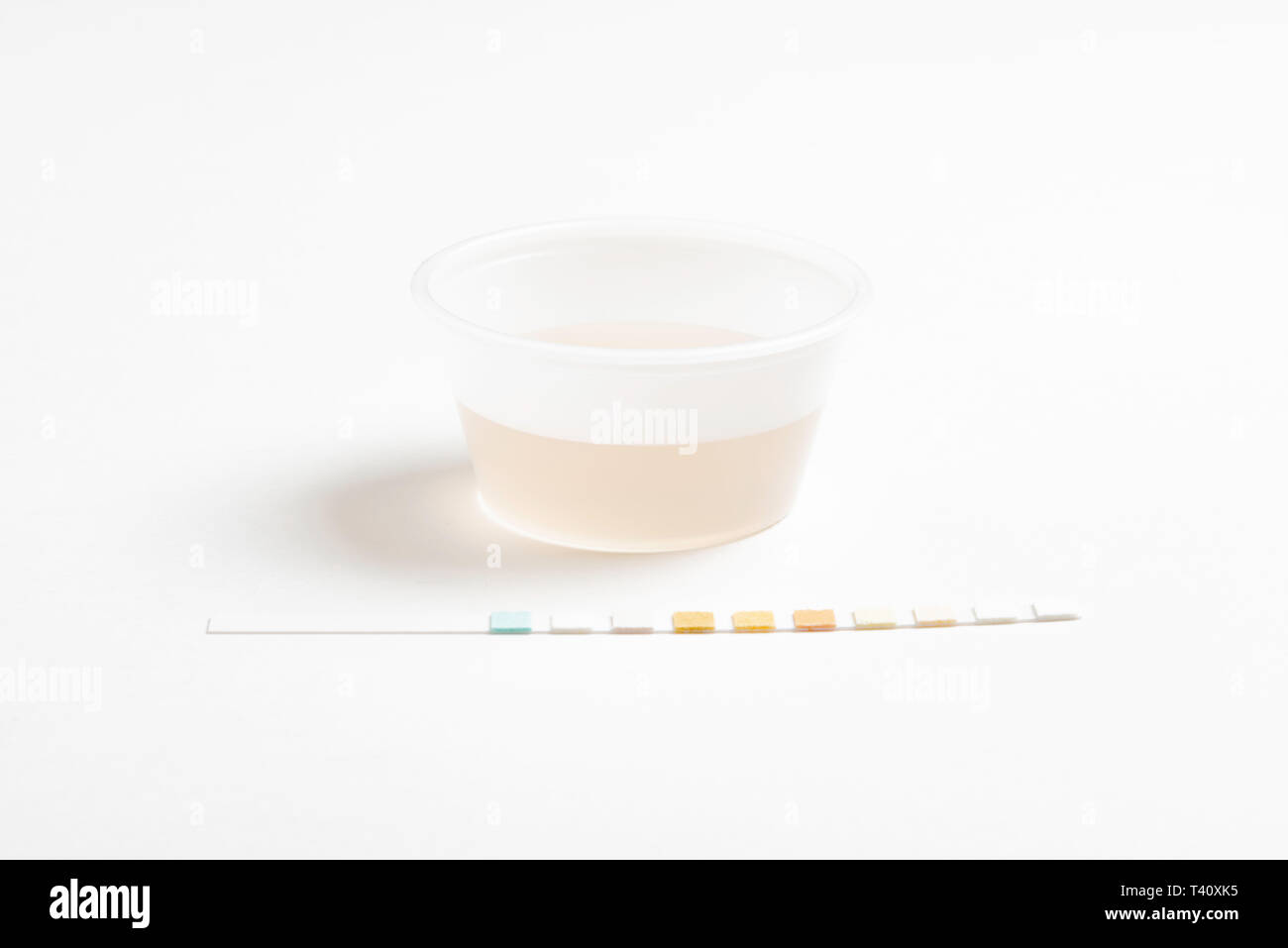 A urine sample in a plastic container with a reagent strip set on a ...