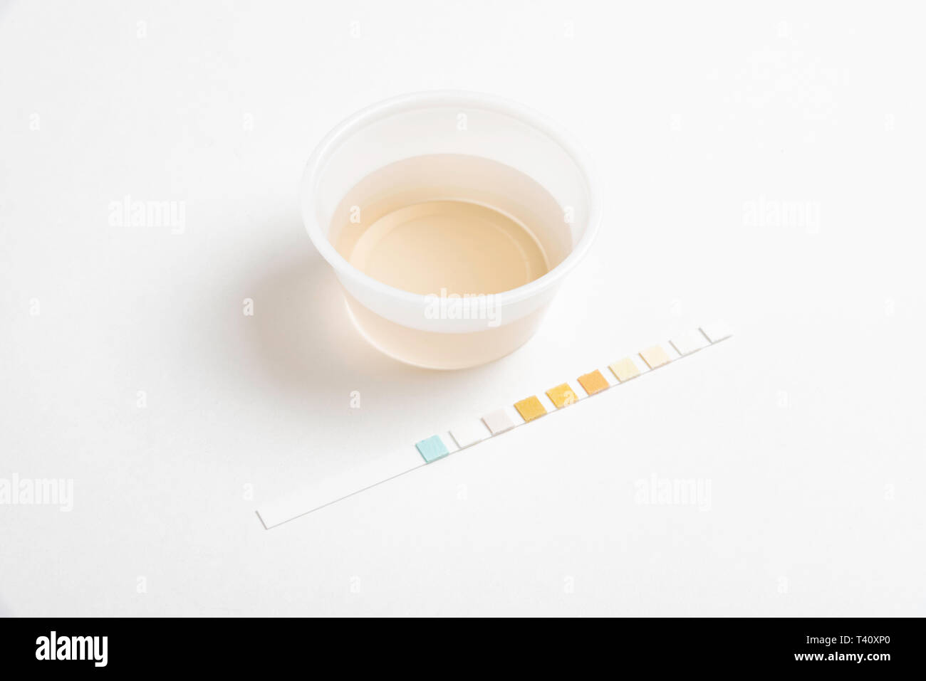 A urine sample in a plastic container with a reagent strip set on a ...