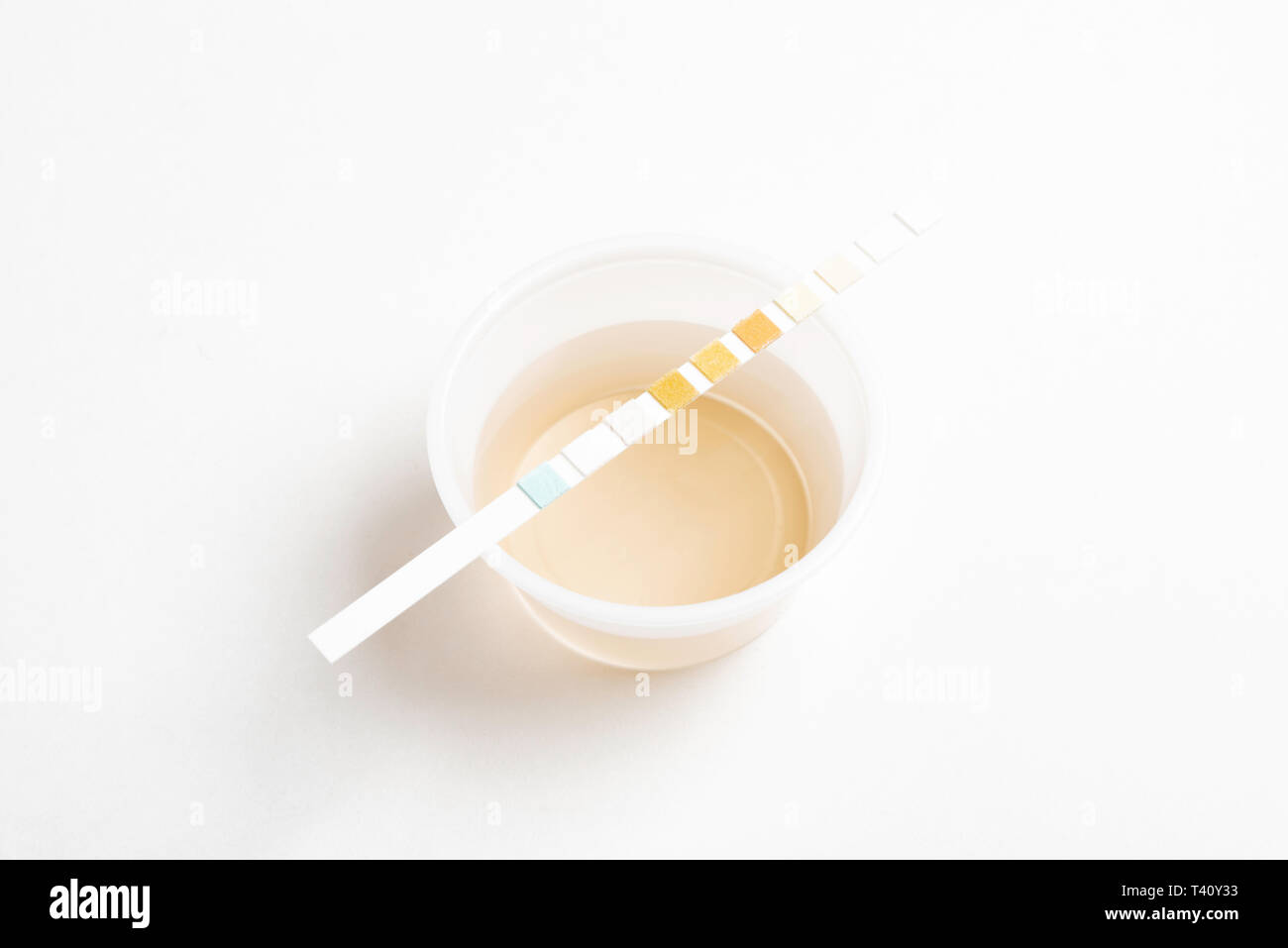 A urine sample in a plastic container with a reagent strip set on a ...