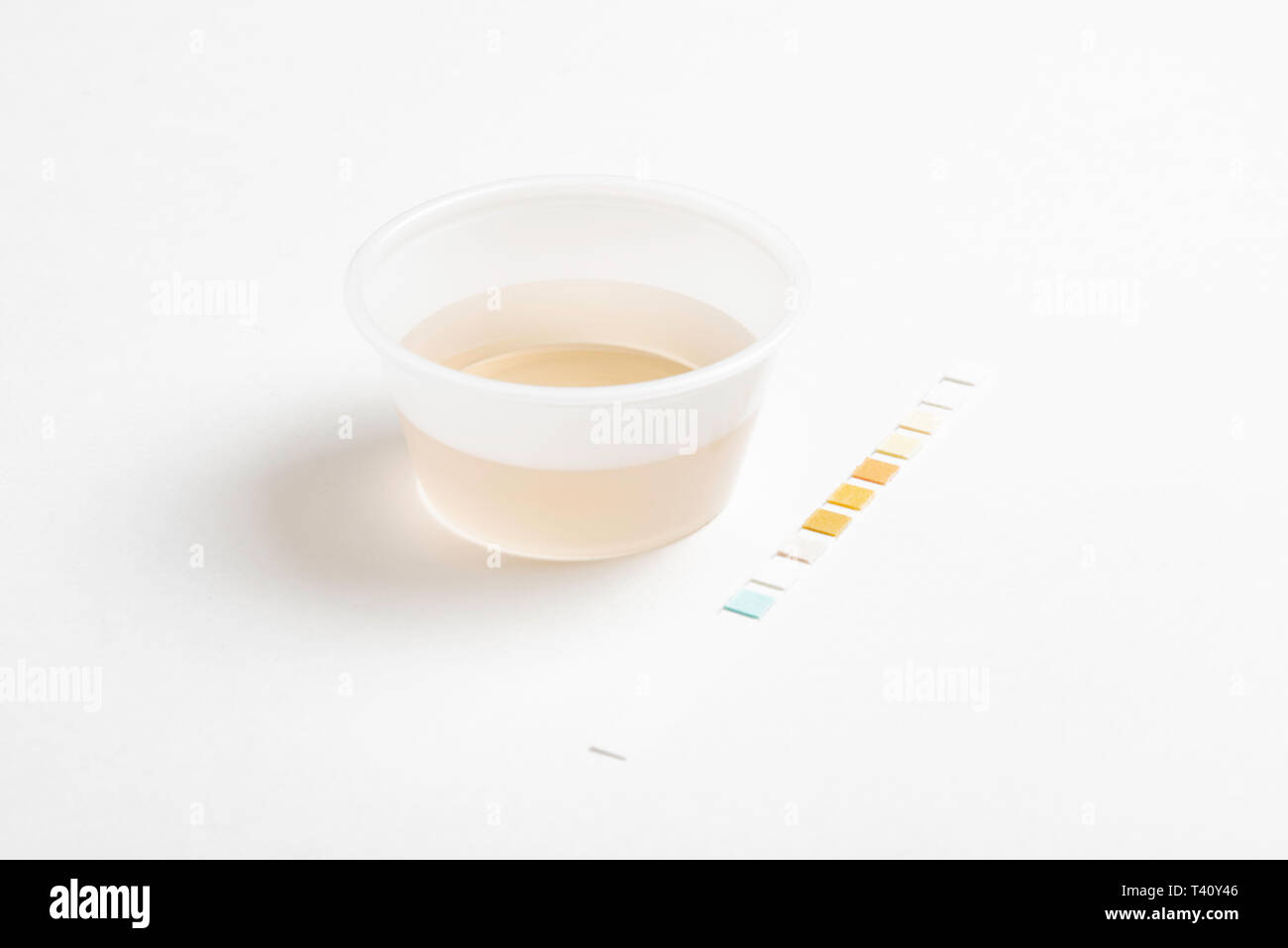 A urine sample in a plastic container with a reagent strip set on a ...
