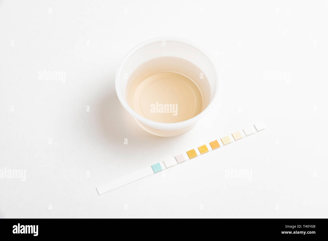 A urine sample in a plastic container with a reagent strip set on a ...