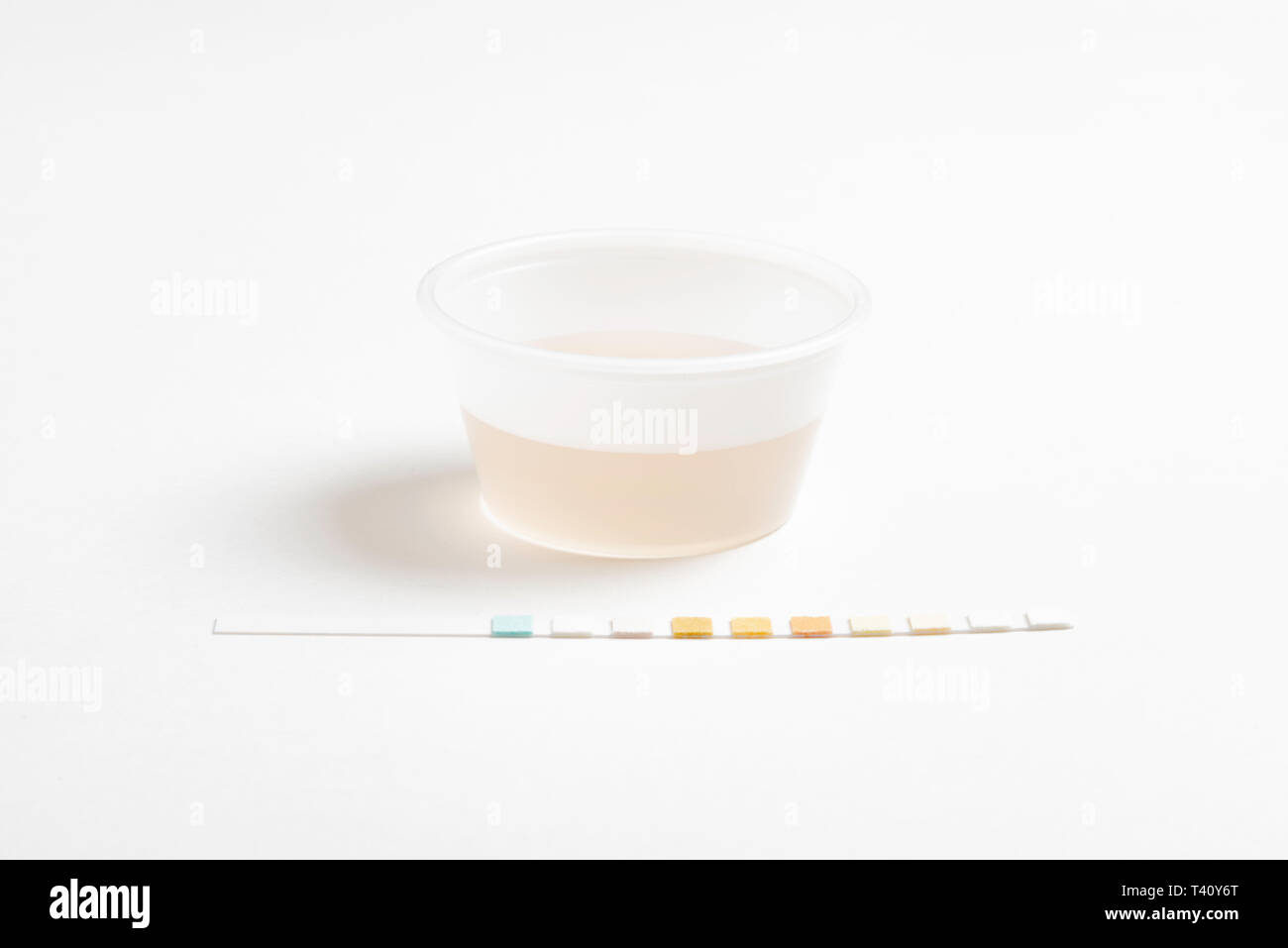 A urine sample in a plastic container with a reagent strip set on a ...