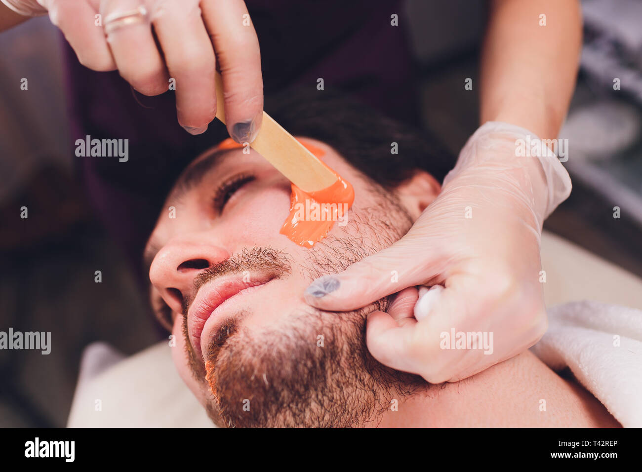 Hair removal. Man's face sugaring epilations beard trimming, yellow ...