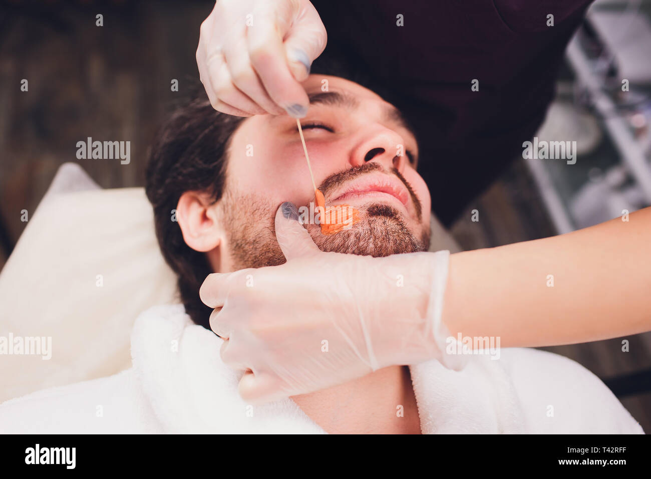 Hair removal. Man's face sugaring epilations beard trimming, yellow ...