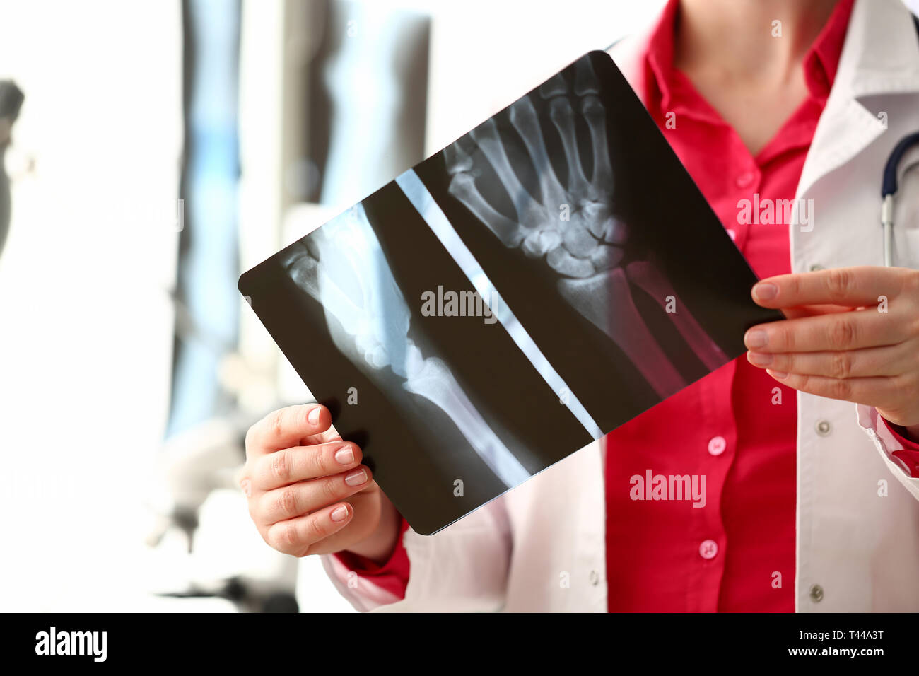 Female radiologist hold in hand xray film Stock Photo - Alamy