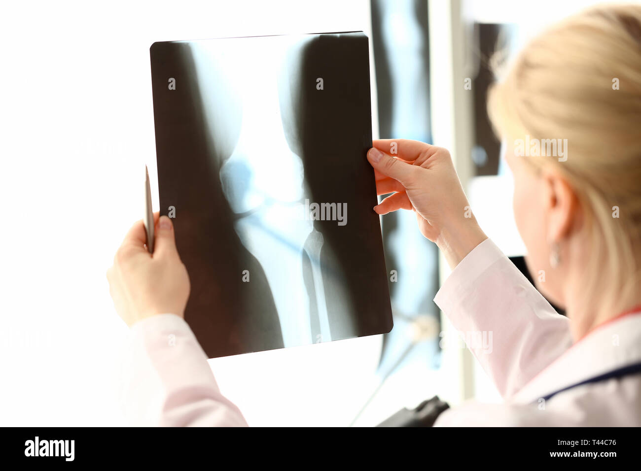 Female radiolog holding in hands x-ray Stock Photo - Alamy