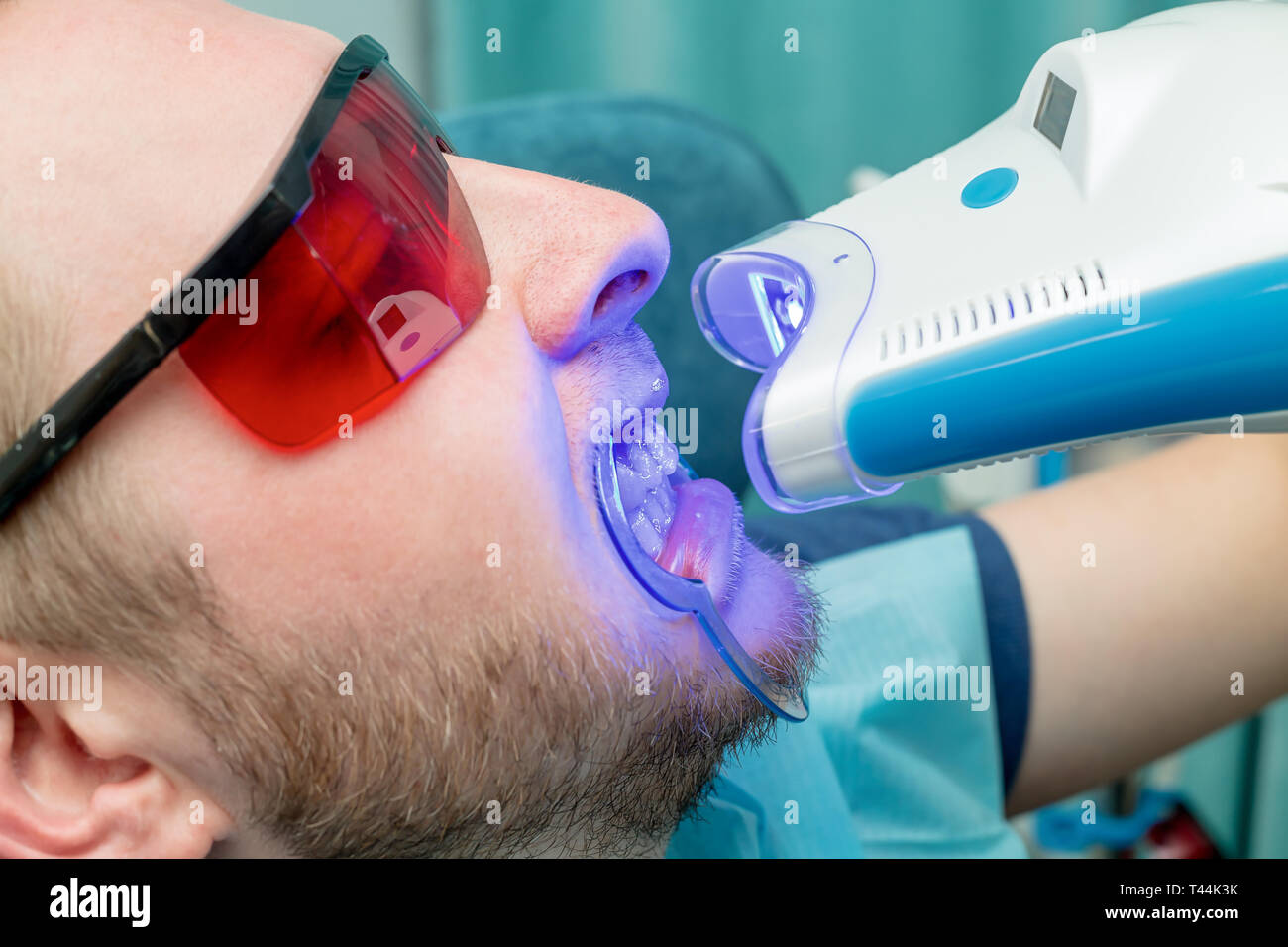 UV whitening teeth procedure. Dental care concept Stock Photo - Alamy