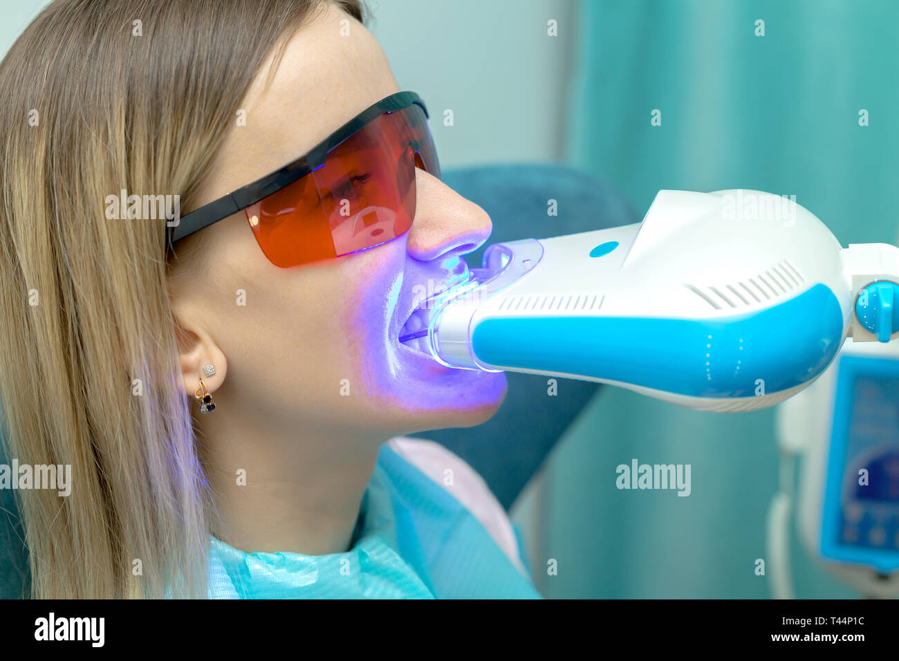 UV whitening teeth procedure. Dental care concept Stock Photo - Alamy