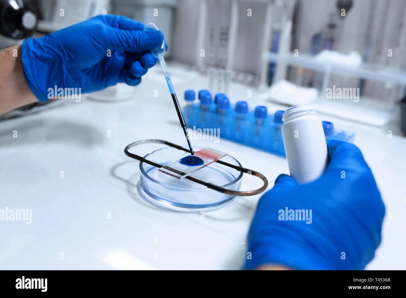 scientist prepare blood sample for research on microscope. Placing ...