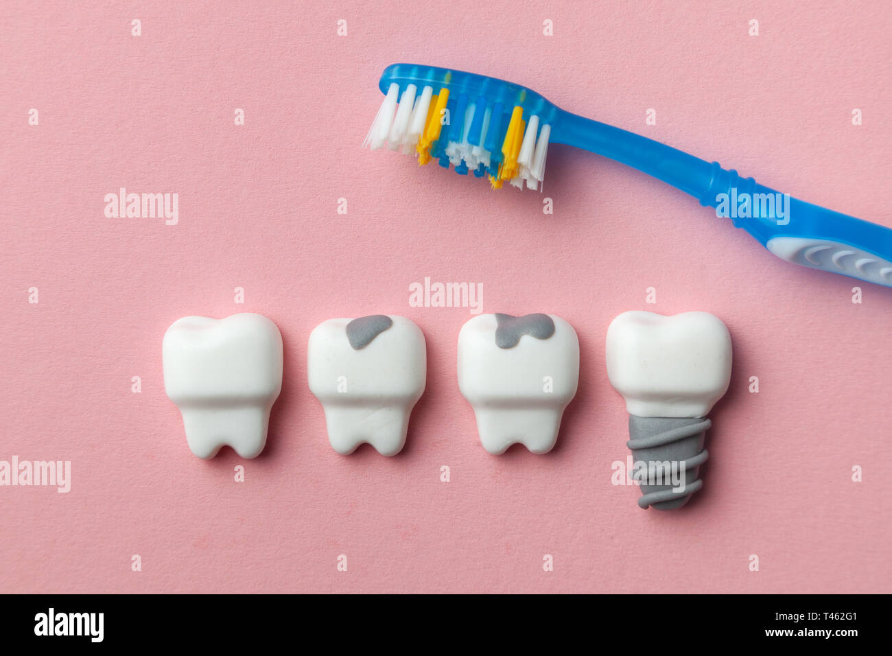 Healthy white teeth and implant and the tooth with caries sad on pink ...