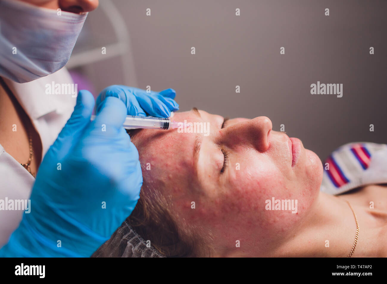 Beautician making injection in woman's face, closeup. Biorevitalization ...