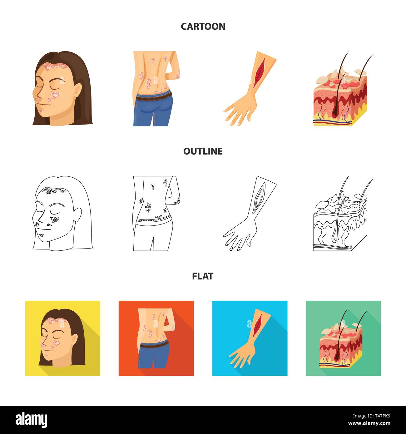 Chronic wound Stock Vector Images - Alamy