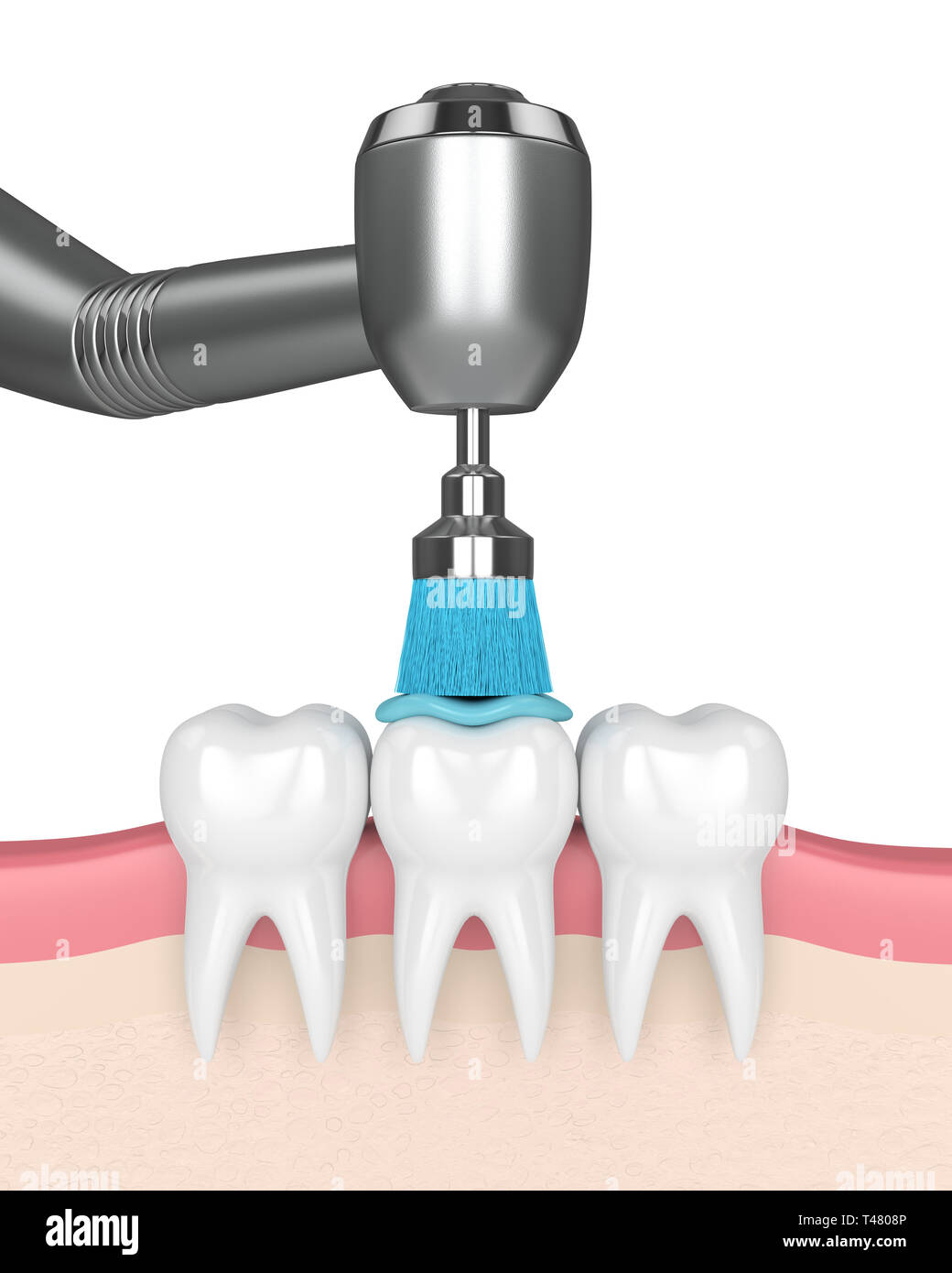 Teeth polishing procedure hi-res stock photography and images - Alamy