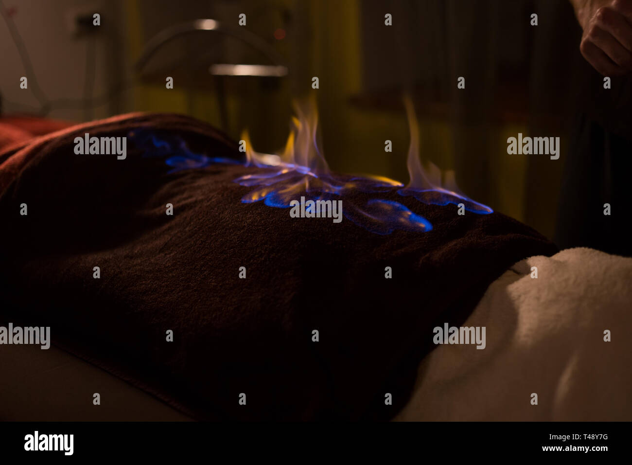 Chinese fire massage - Huo Liao therapy. Traditional chinese medicine ...