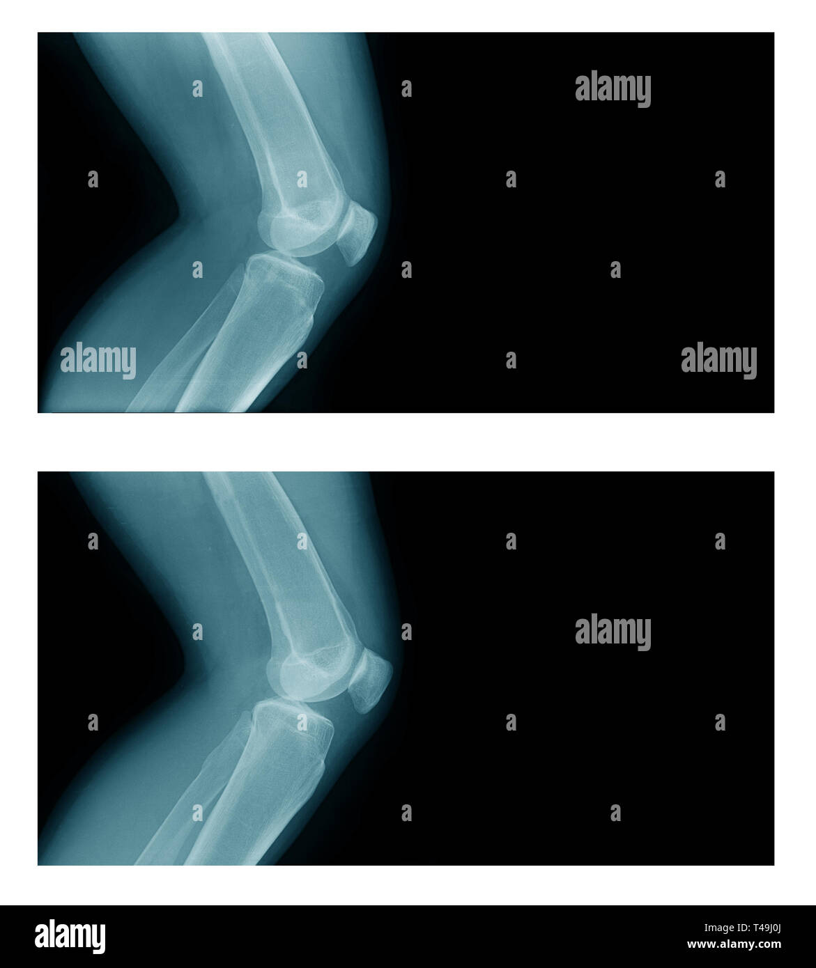 x-ray image knee joint with banner design for webpage and hight quality ...