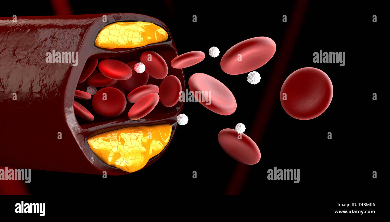 Saturated healthcare system hi-res stock photography and images - Alamy