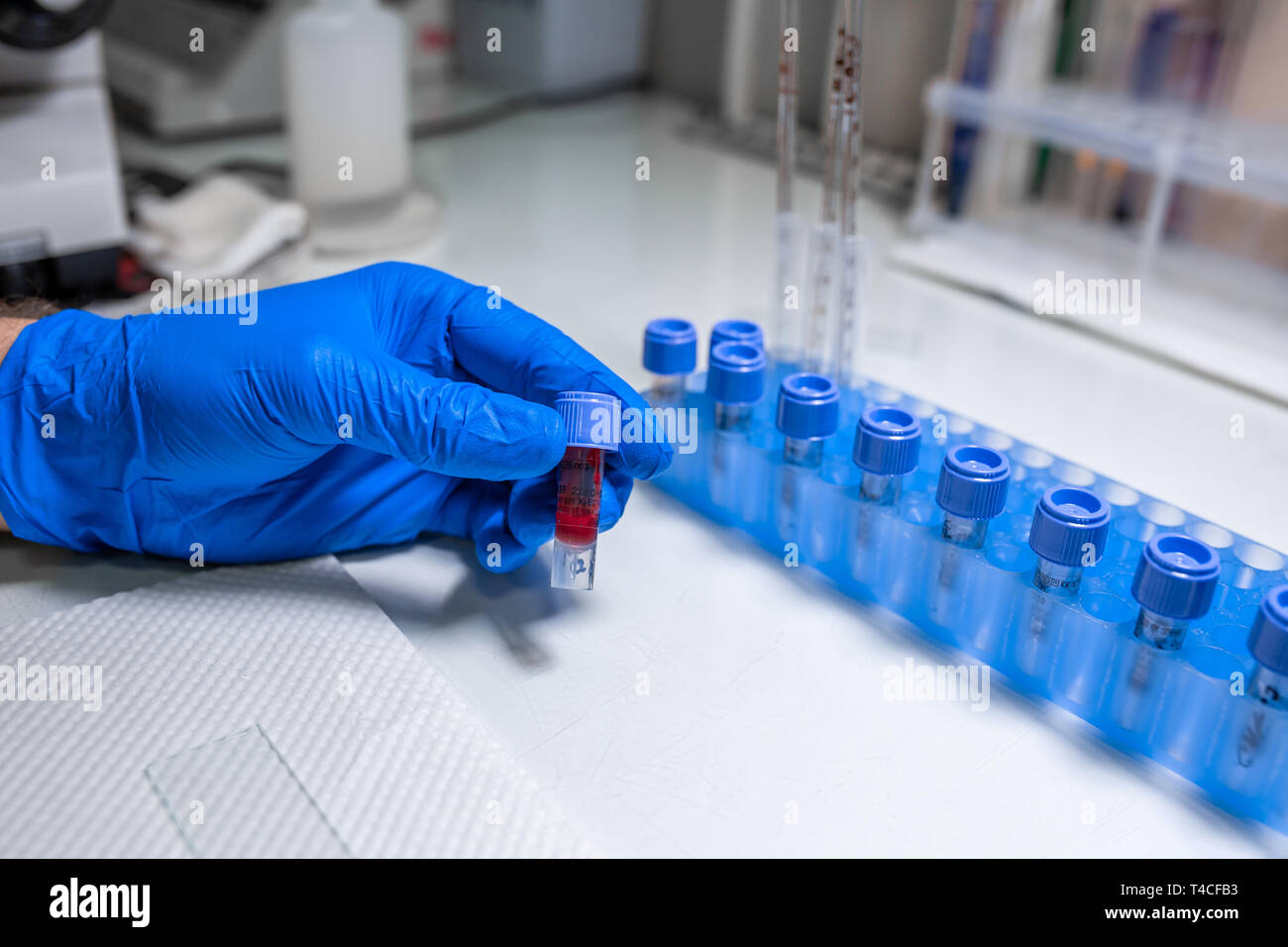 scientist prepare blood sample for research on microscope. Placing ...