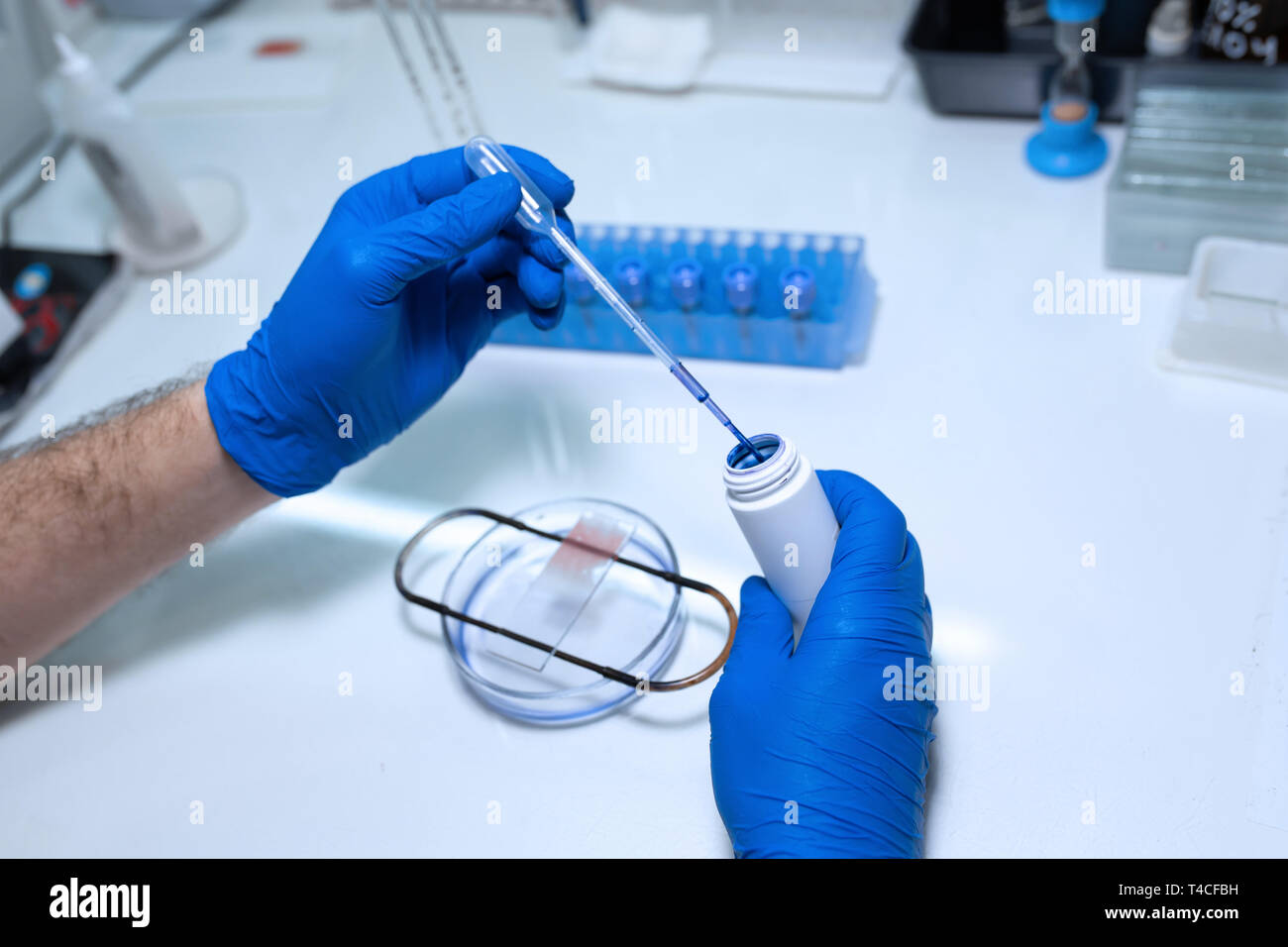 scientist prepare blood sample for research on microscope. Placing ...